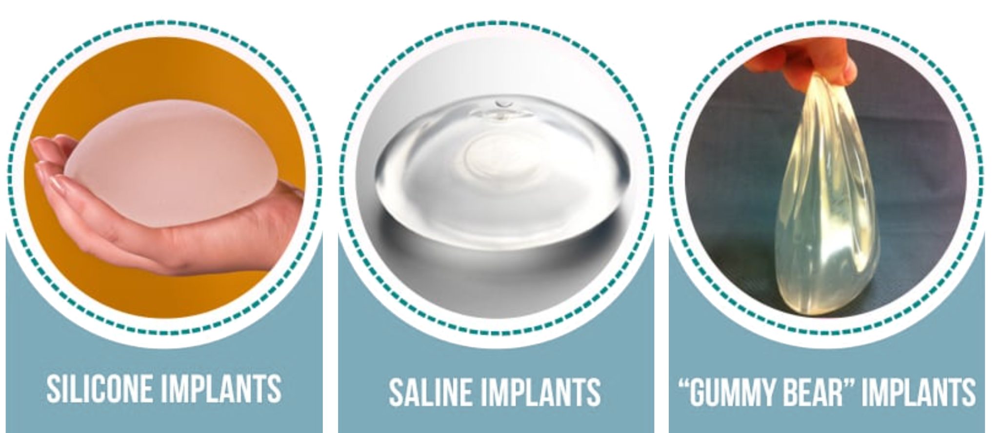 Best Breast Implants Saline Silicone Gummy Bear Orlando Fl
